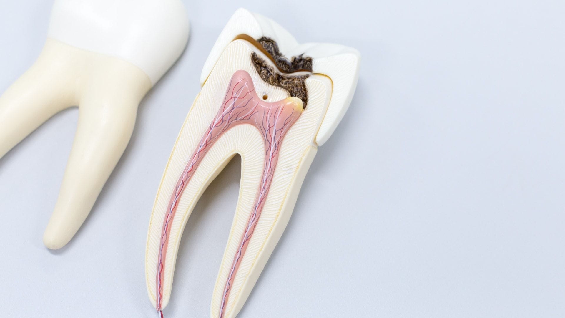 Expertos en Endodoncias | Clínica dental IMOI